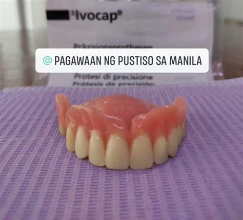 Pagawaan Ng Pustiso Sa Pagawaan Ng Pustiso Sa Manila