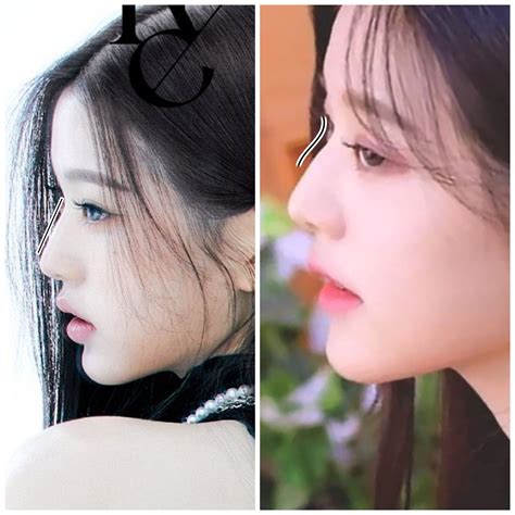 Iu Plastic Surgery Anglea Bueno
