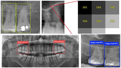 ai dental assistant reads x rays with near perfect accuracy news