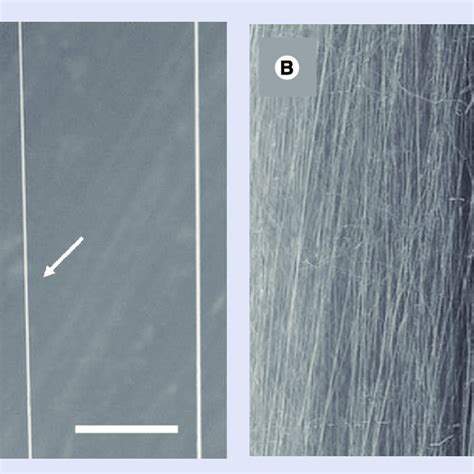 Example Of Scanning Electron Micrograph Of Oriented Polycaprolactone Download Scientific