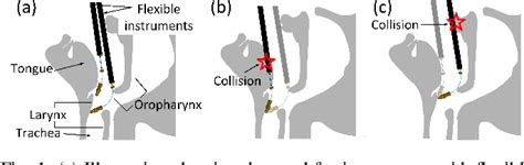 Figure 1 From A Variable Length Variable Stiffness Flexible Instrument