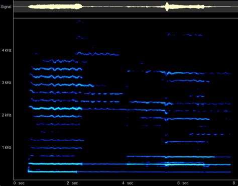 Spectrogram Of The Vowel I In Four Conditions Of The Jaw Forward Download Scientific Spectrogram Of The Vowel I In Four Conditions Of The Jaw Forward Download Scientific