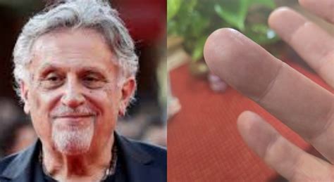 Andrea Ronca To Punto Da Vespa Orientalis A Roma La Sua Reazione E Consigli Per Evitar E