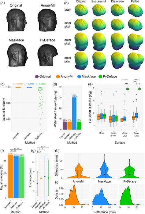 Mri Similarity And Source Localization Analyses A Example Of 3d Download Scientific Diagram