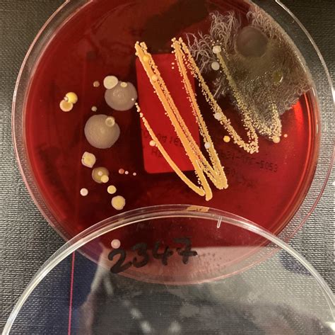 Pop Up 2025 Body Swabs 11th July — Superbugs The Microbial World In On And Around Us