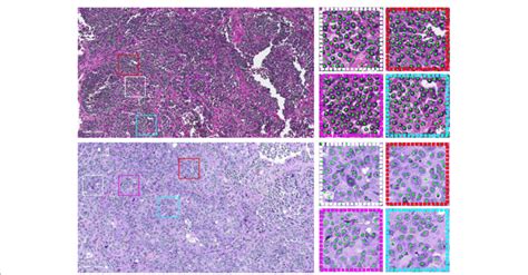 Qualitative Cell Detection Results For Two Large Image Patches Several