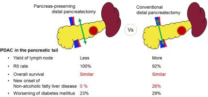 Clinical Efficacy Of Pancreas Preserving Distal Pancreatectomy For The