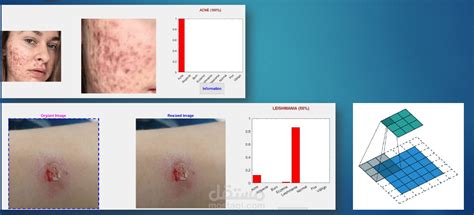 تشخیص أمراض الجلد بواسطة صورة أو عن طریق كامیرا مستقل