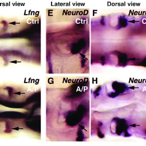 The Ap Axis Of The Inner Ear Is Not Affected By Ap Axial Rotation Of