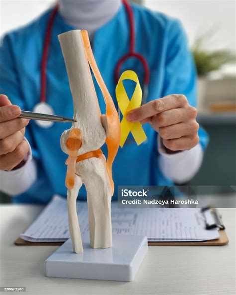 닥터 무릎 관절 해부학 클리닉에서 모델 및 인식 리본 뼈의 암 종양학 개념 외상학에 대한 스톡 사진 및 기타 이미지 외상학 인간 척추 건강 진단 Istock