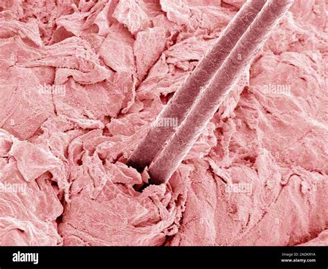 Human Hair Coloured Scanning Electron Micrograph Sem Of Human Hairs