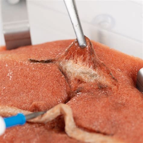 Vessel Dissection Model Kotobuki Medical Surgical Training Models