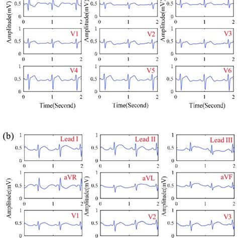 Pdf Design Of A Wearable 12 Lead Noncontact Electrocardiogram Monitoring System