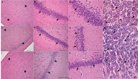 Cerebral Cortex Tissue
