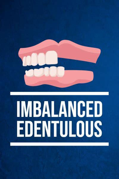 Fully Digital Immediate Denture Workflow Is1 D 2 Visits Rdl Russellville Dental Lab