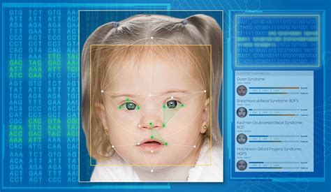 From Facebook Facial Recognition To Genetic Disease Identification