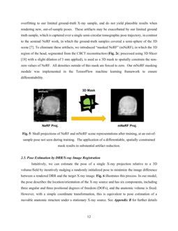 Robust Single View Cone Beam X Ray Pose Estimation With Neural Tuned Tomography NeTT And