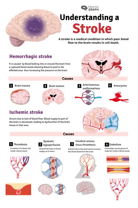 Stroke Causes Cardiology3 Mind The Graph Blog