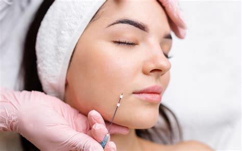 Νήματα Pdo προσώπου Γλιαρμή Ελευθερία