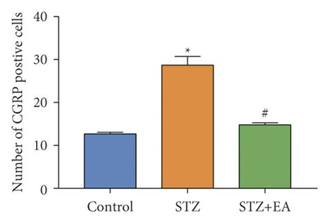 If Results Of Trpv1 Sp And Cgrp In Drg Of Dnp Rats After Ea
