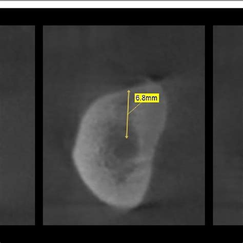A Ct Scan Before Surgery Download Scientific Diagram