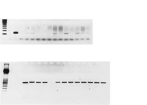Nested Polymerase Chain Reaction PCR Assay For Carcinoembryonic Download Scientific Diagram