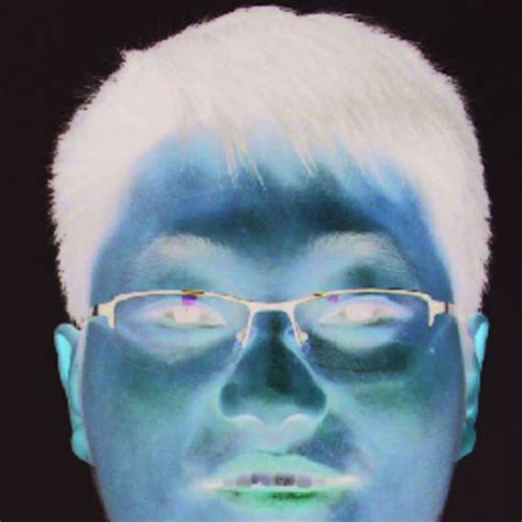 Jiangang Sun Zhengzhou University Zhengzhou Zzu Clinical Department Of Medicine