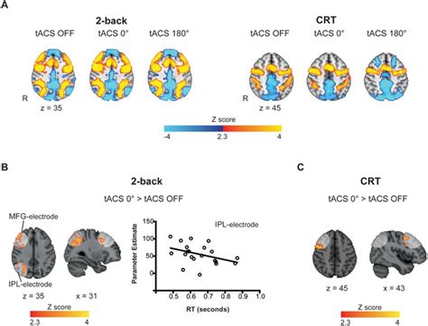 figures and data in externally induced frontoparietal synchronization