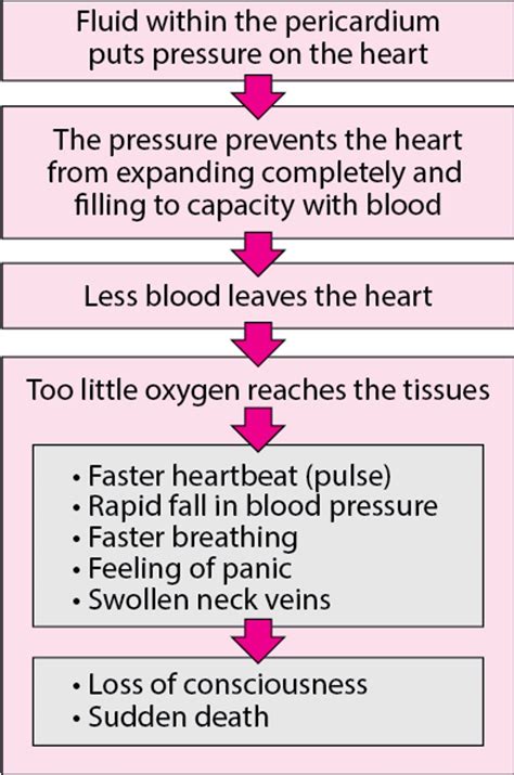 Image Cardiac Tamponade Msd Manual Consumer Version