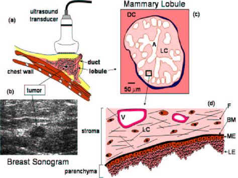 Figure 1 From Advanced Ultrasonic Imaging Techniques For Breast Cancer Research 1 Semantic Scholar