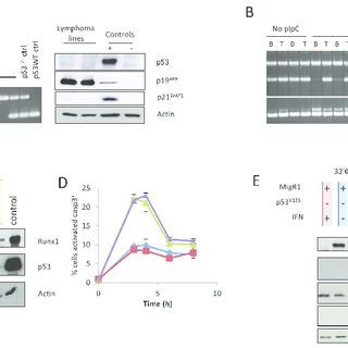 Gene expression changes specific for Runx1 deletion in Eµ Myc lymphoma Download Scientific