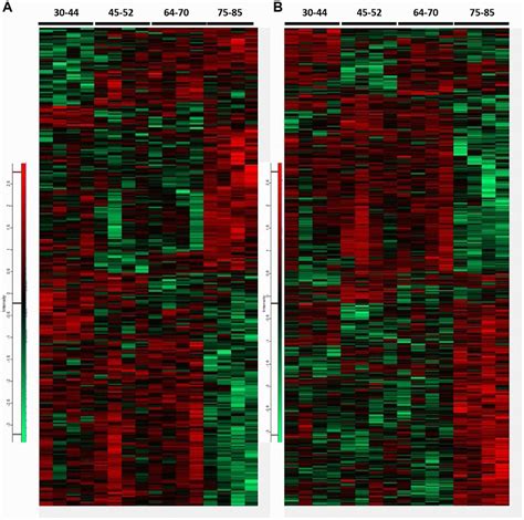 Aging Aging Us On Linkedin Proteostatic Modulation In Brain Aging
