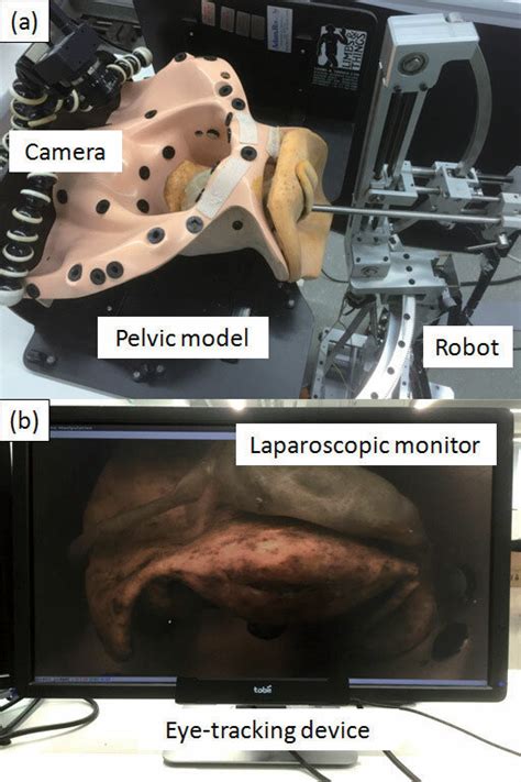 The Setup Of The System A The Setup On The Robot S Side B The Download Scientific Diagram