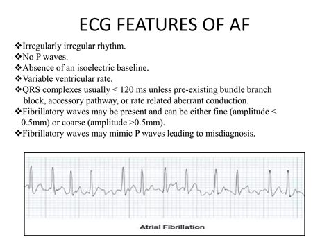 Atrial Fib And Flutter Pptx Heart And Cardiovascular Diseases Diseases And Conditions