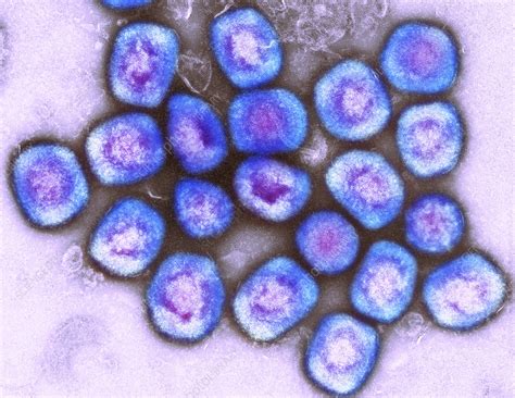Monkeypox Virus Particles Tem Stock Image C0563351 Science