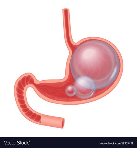 Realistic Abdominal Bloated Stomach Illustration Isolated Transperant