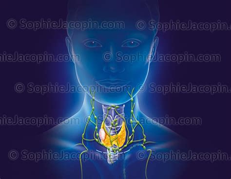 Nodule Hypodense De La Thyroïde Fynsr
