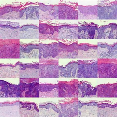 Random Samples Of 256 × 256 Pixel Iec Images As Seen In Download