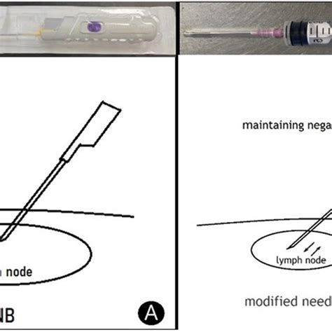 The Visuals Of Both Methods A Core Needle Biopsy Cnb Use Bard