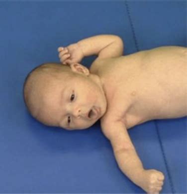 PEDS Development Flashcards Quizlet