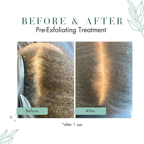 Pre Exfoliating Scalp Treatment Exfoliation Comb Hair Divinity
