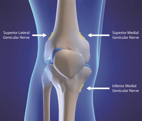 Genicular Nerve Block Ispine