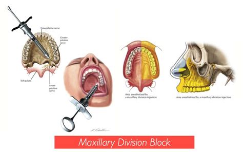 V2 Block Dentistry Dental Hygienist Education Dental Hygiene