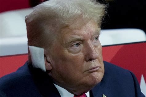 Why Hasn T Trump Shown Us The Wound On His Ear And Other Idiotic Observations From The Left