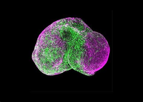 Assembloid Wikipedia