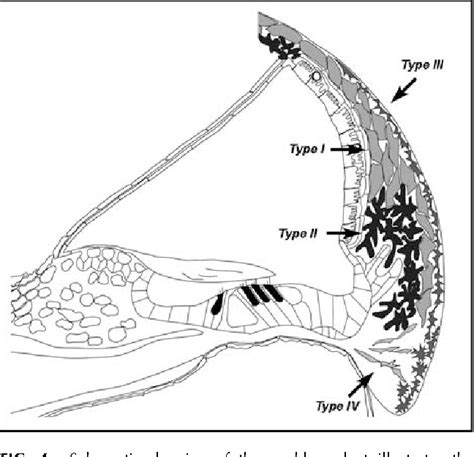 Spiral Ligament Of Cochlea Semantic Scholar