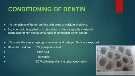 Dentin Bonding Agents Classification Ppt At William Bolyard Blog