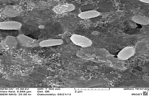 Sem Images From Outer Surface Of Anode Electrode After Using In Anode
