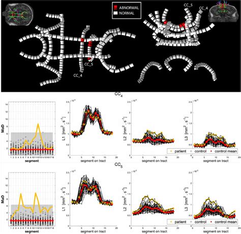 Patient Specific Microstructural Anomaly Detection With Mad Tract Download Scientific Diagram