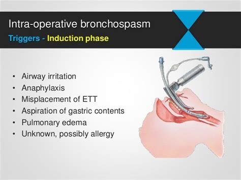 Management Of Intraoperative Bronchospasm
